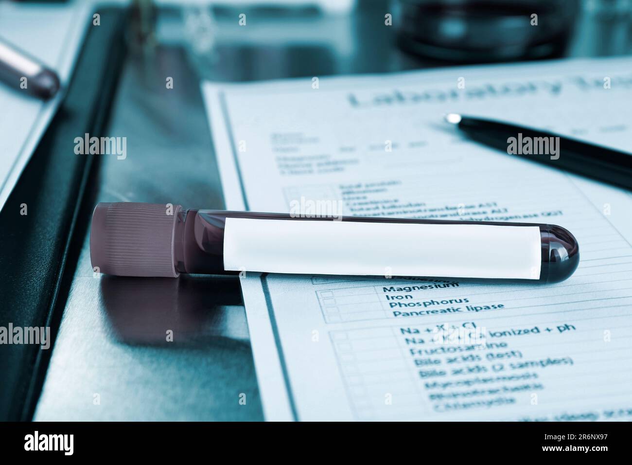 Test tube with blood sample on medical form. Color toned Stock Photo ...