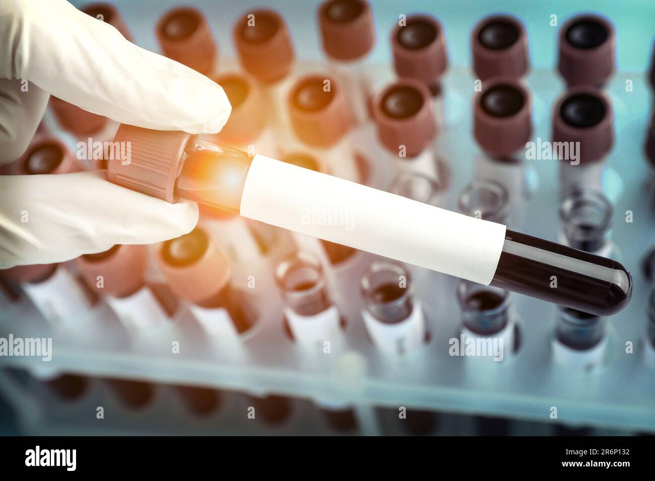 Laboratory worker holding test tube with blood sample over rack ...