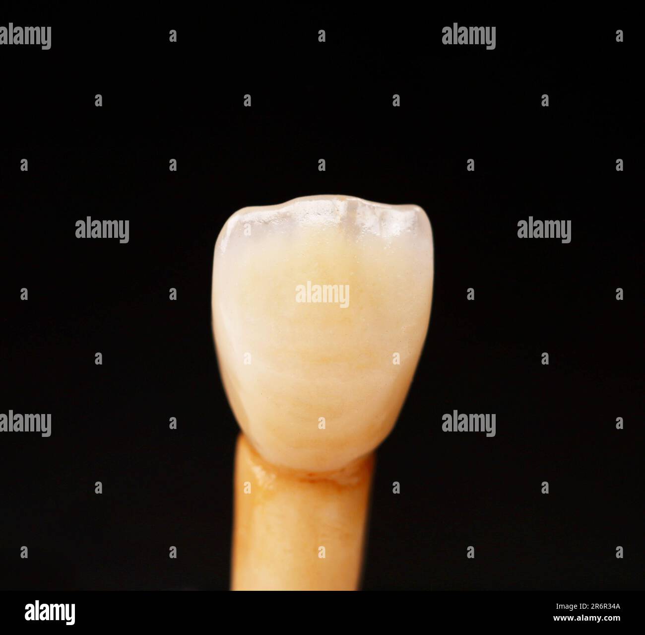 finished ceramic front crowns, a black background Stock Photo - Alamy