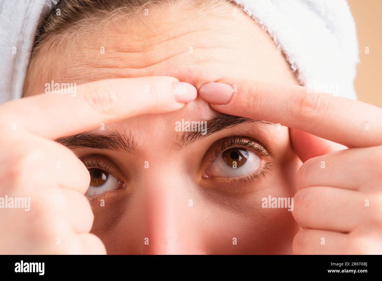 Squeezing pimples, acne, blemish spots skin on on face of young woman ...