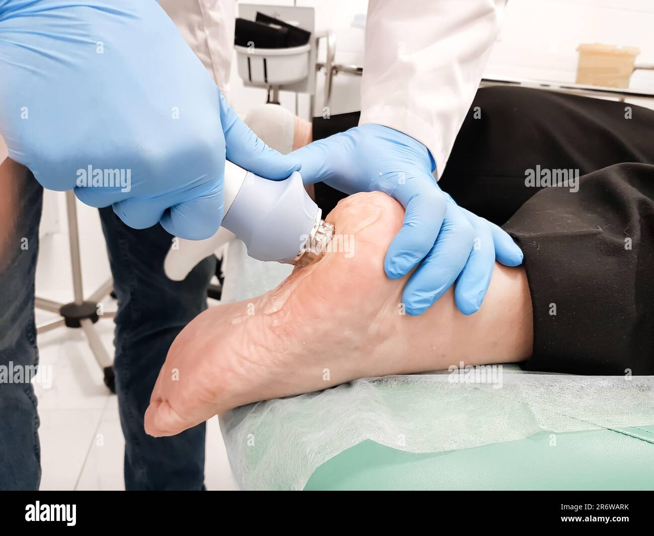 Extracorporeal shock wave therapy ESWT of heel. Visit to office of ...