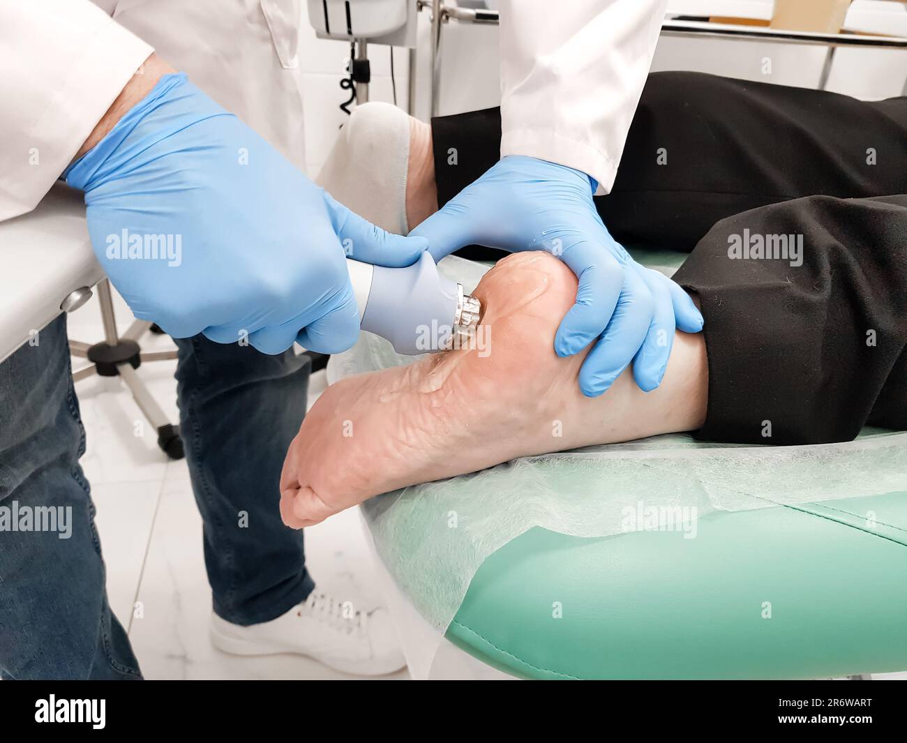 Extracorporeal shock wave therapy ESWT of heel. Visit to office of ...