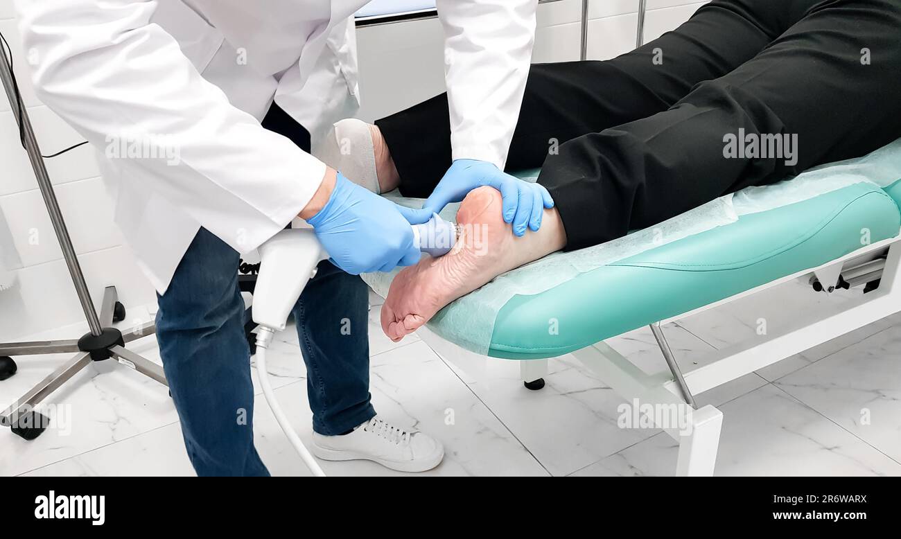 Extracorporeal shock wave therapy ESWT of heel. Visit to office of ...