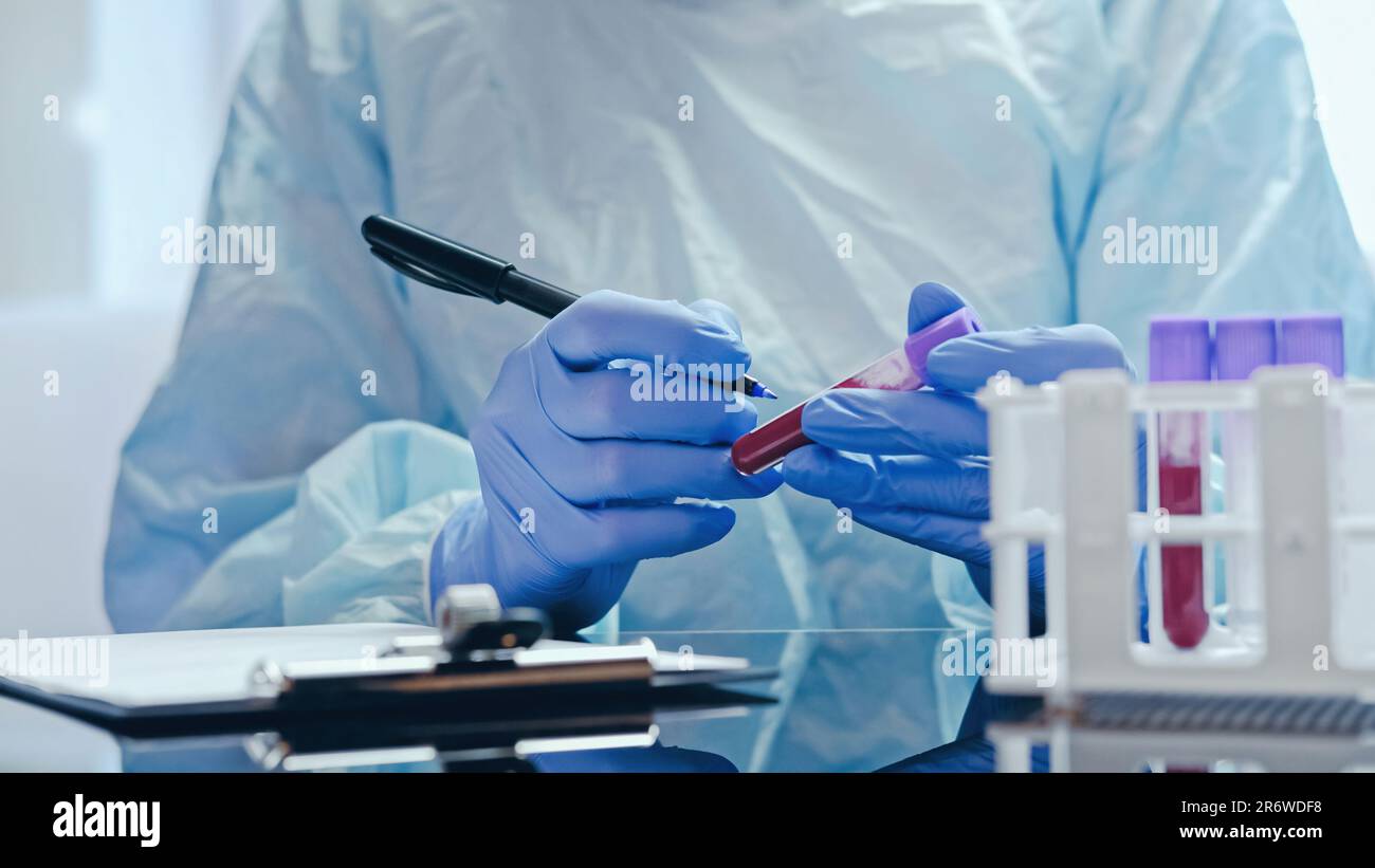 Laboratory diagnostics test technician hands blood Stock Photo - Alamy