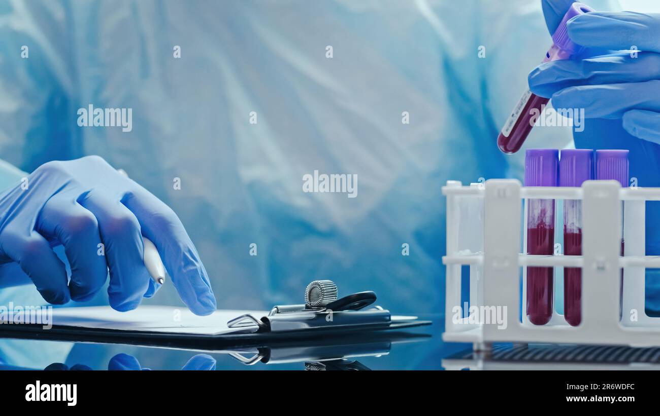 Laboratory test technician hands blood sample Stock Photo - Alamy