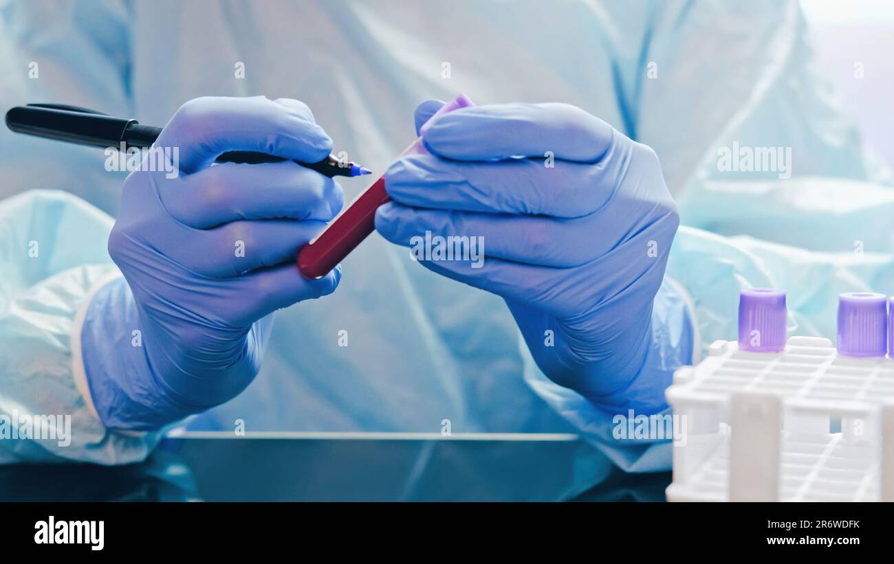 Blood research laboratory technician hands tubes Stock Photo - Alamy
