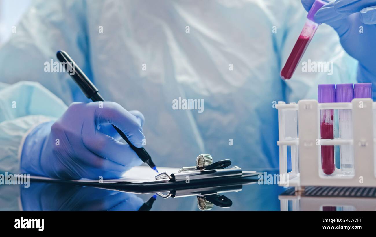Blood sample laboratory nurse hands serum test Stock Photo - Alamy