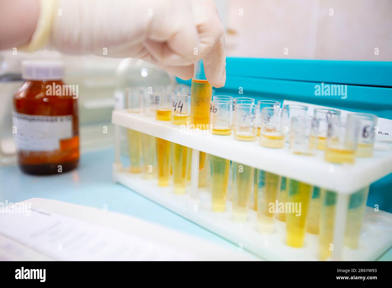 Test tubes with urine tests in a medical biochemical laboratory Stock ...