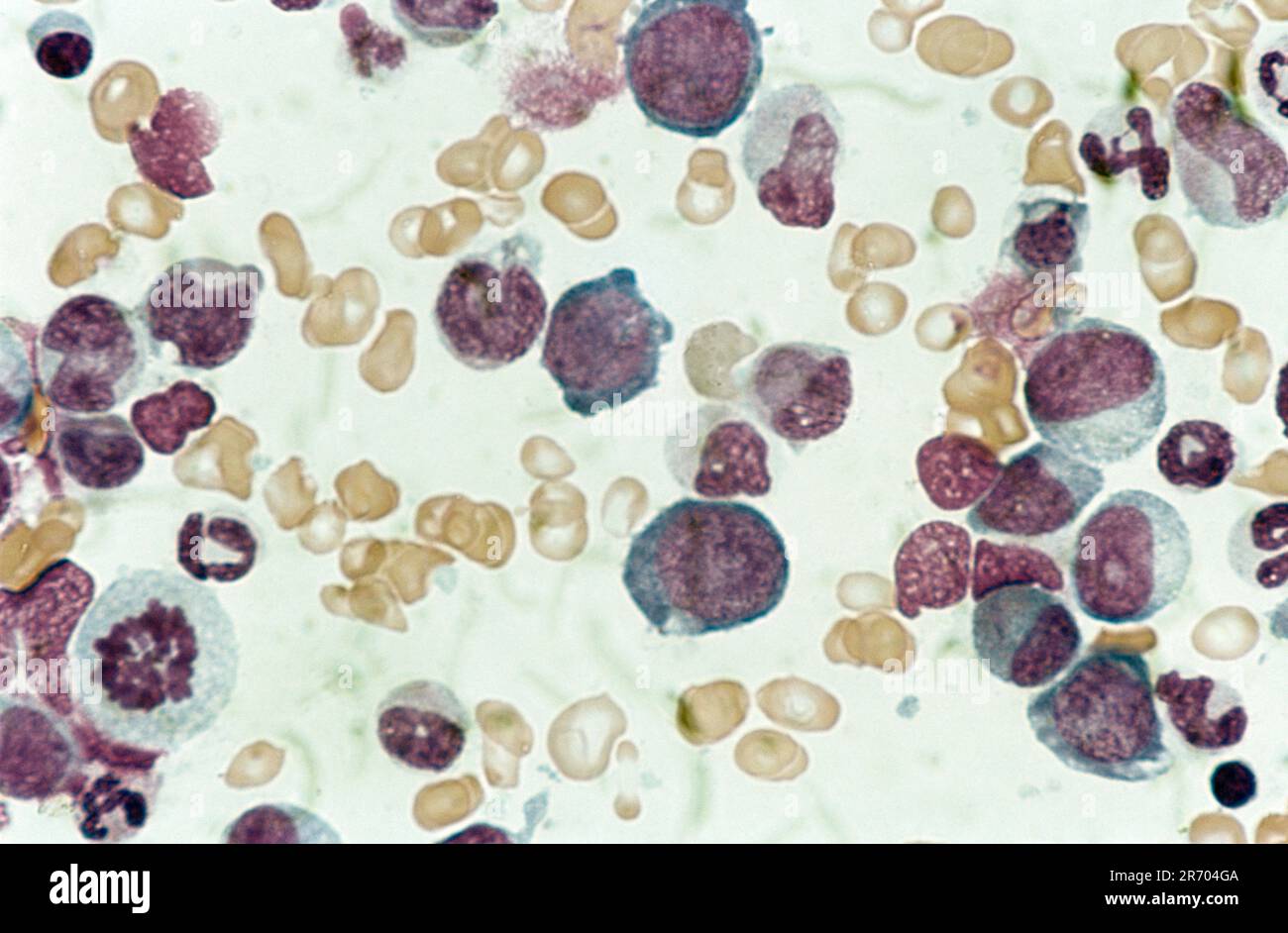 Picture 034Microscopic Image of Dividing Blood Cells Stock Photo - Alamy