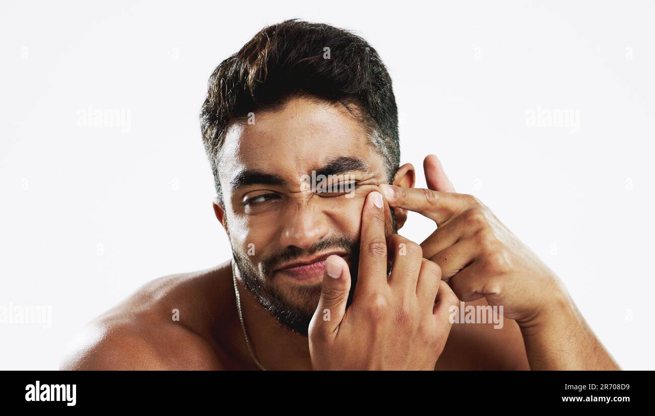 Pimple pop, Indian man and struggling model doing skincare and wellness ...