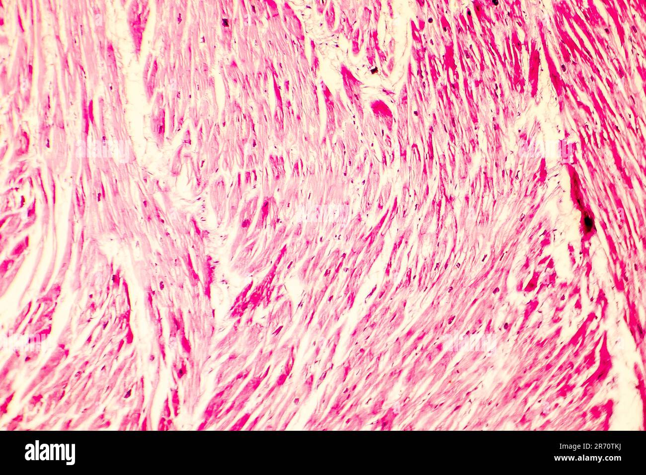 Hypertrophy Muscle Microscope