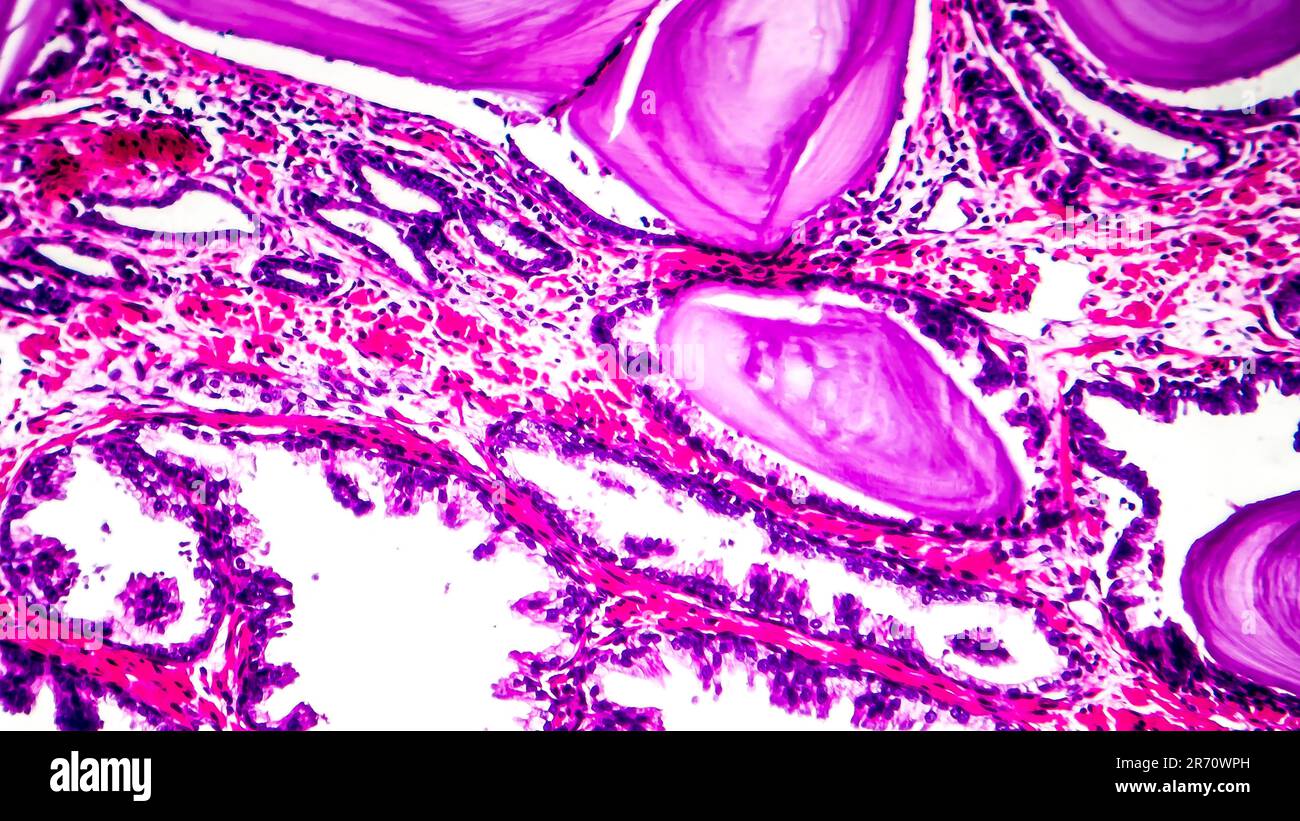 Prostate Histology