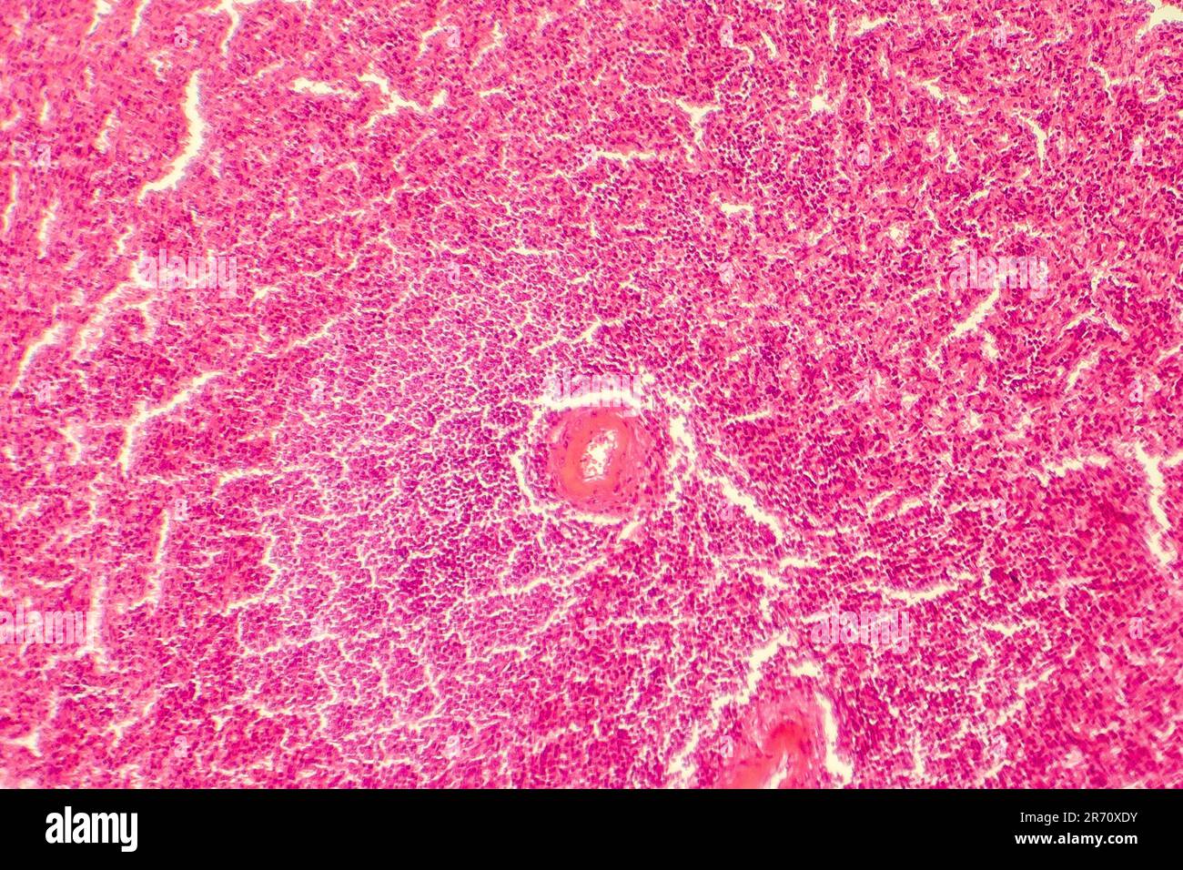Splenic Artery Histology