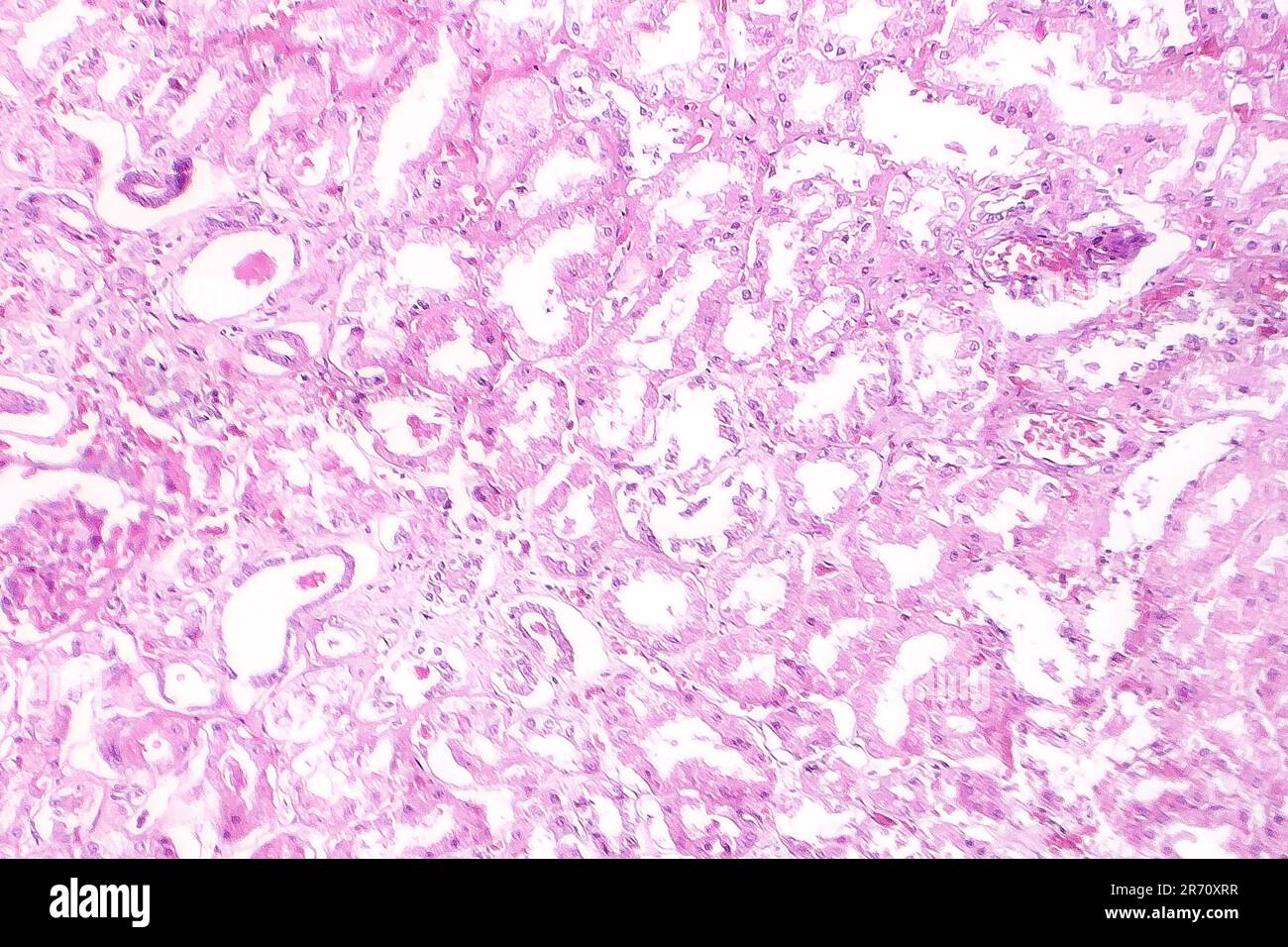 Epithelial tissue hi-res stock photography and images - Alamy