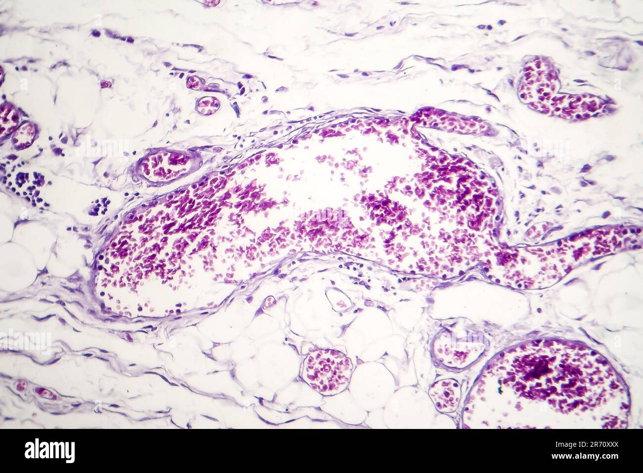 Blood vessels with red blood cells, transevrse section, light ...