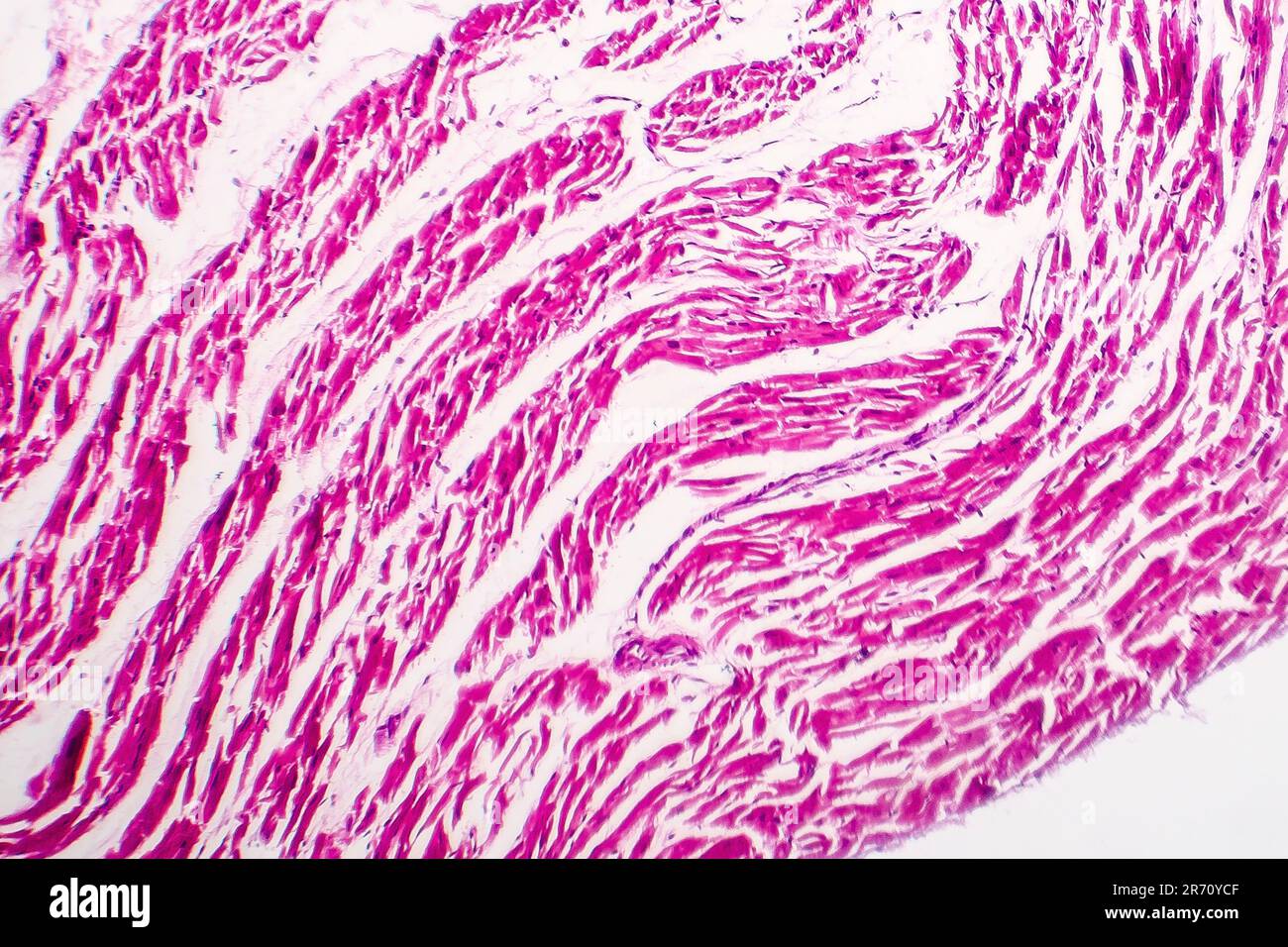 Brown atrophy of the heart, light micrograph, photo under microscope ...