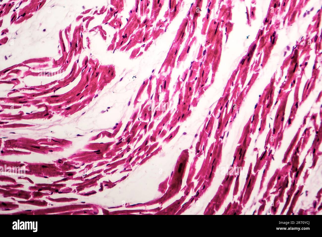 Brown atrophy of the heart, light micrograph, photo under microscope ...