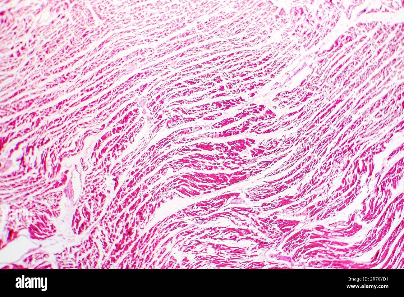 Brown atrophy of the heart, light micrograph, photo under microscope ...