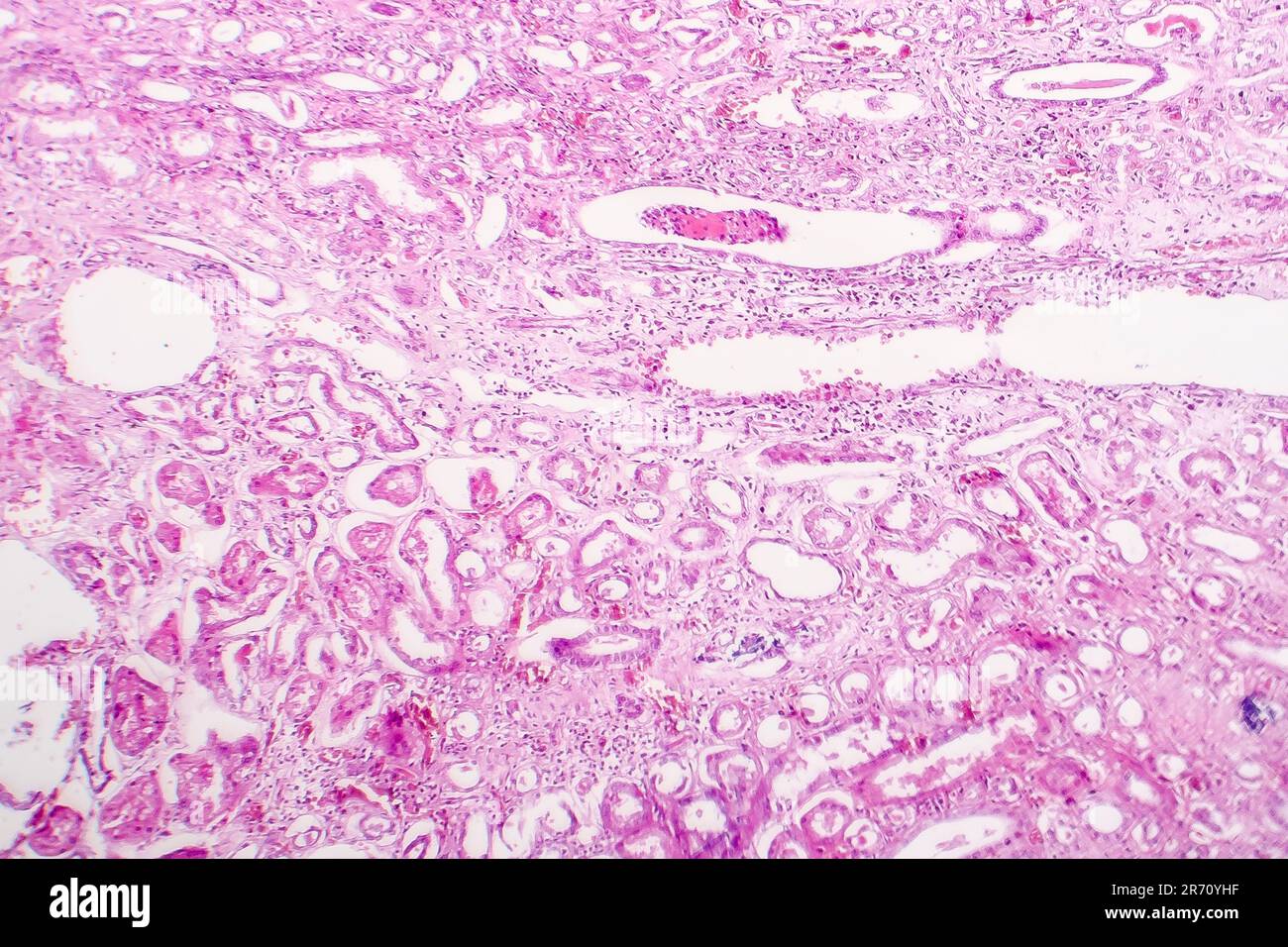 Renal Tubular Cells
