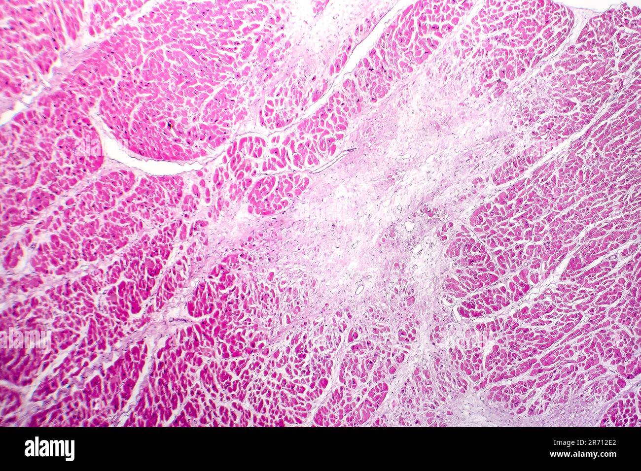 Myocardium Histology