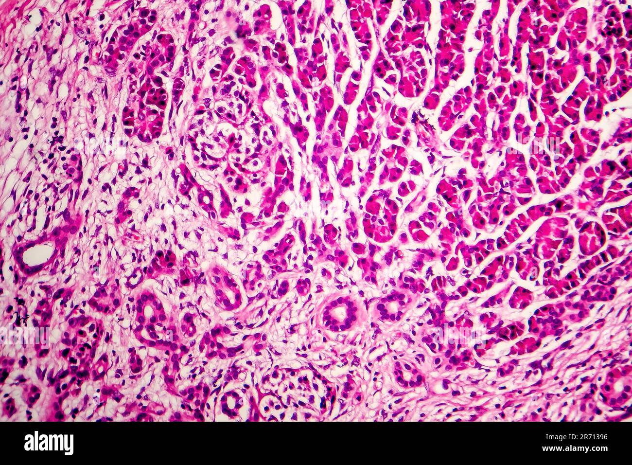 Islet langerhans light micrograph hi-res stock photography and images ...