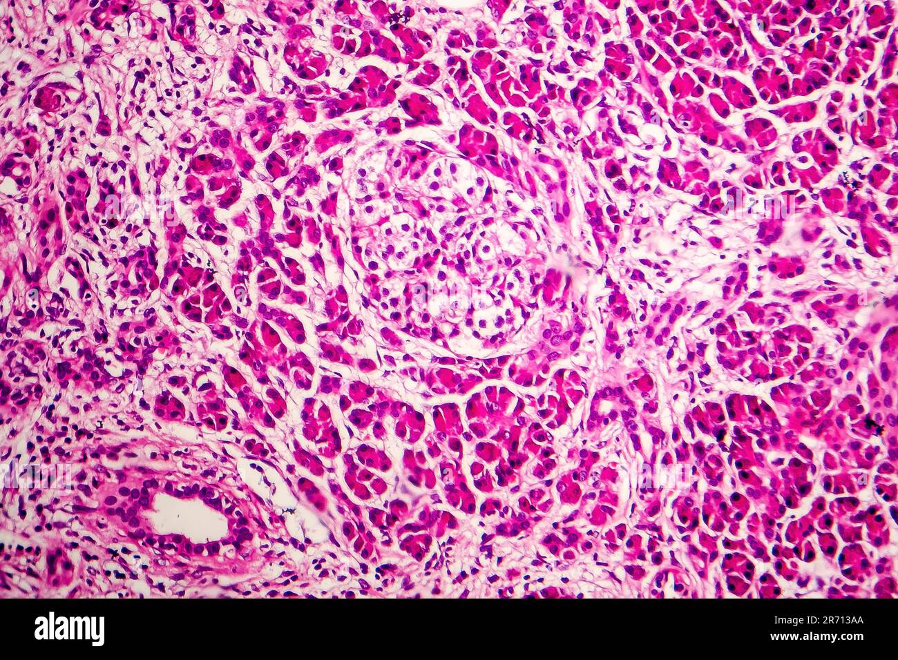 Islet langerhans light micrograph hi-res stock photography and images ...