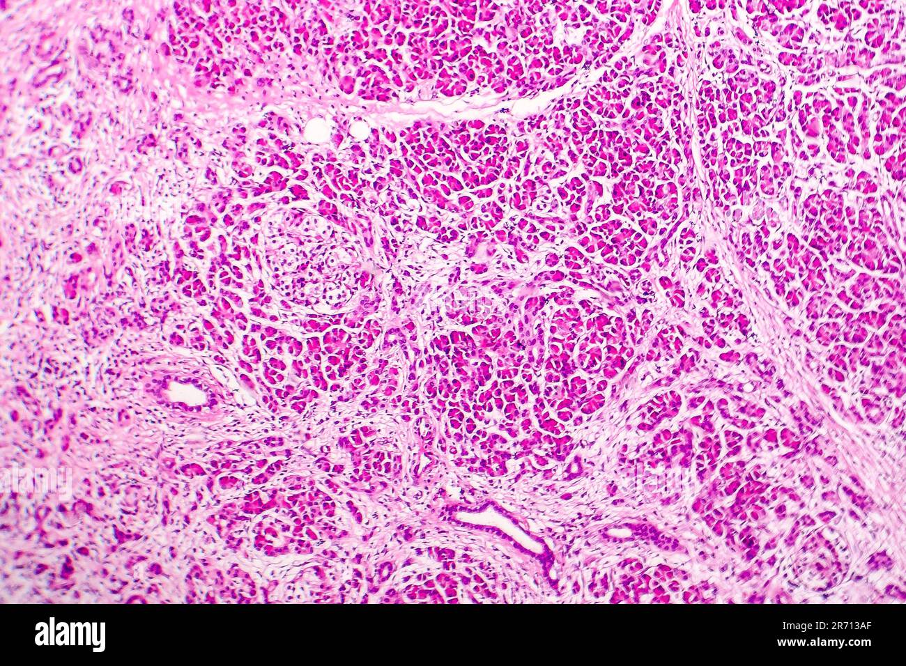 Islet langerhans light micrograph hi-res stock photography and images ...