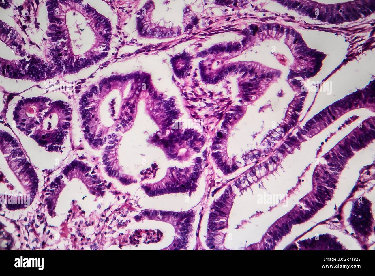 Large intestine microscope hi-res stock photography and images - Alamy