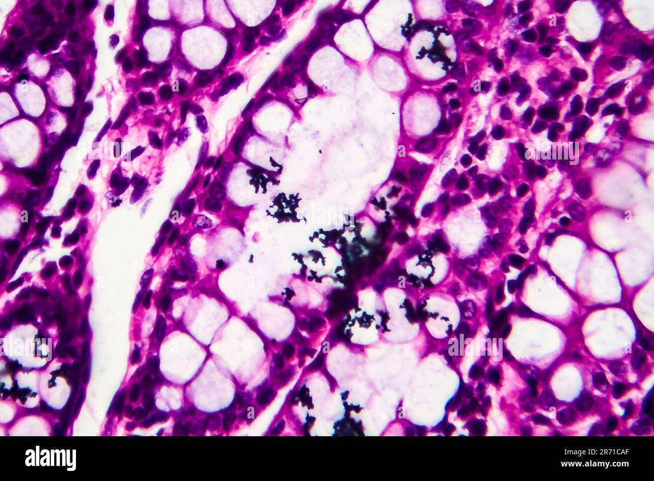 Bacteria cell under light microscope hi-res stock photography and ...