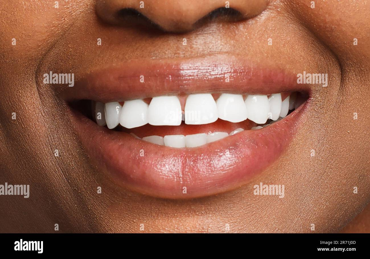 Female smile with natural white teeth closeup Stock Photo - Alamy