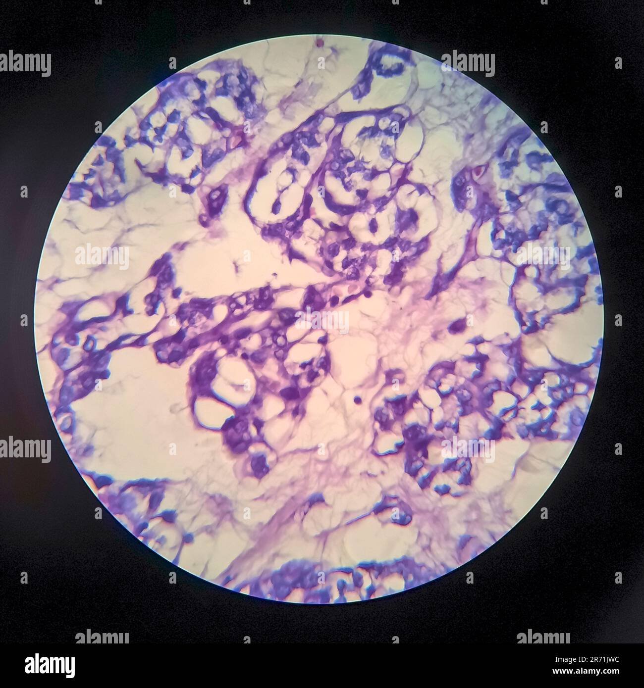 Human thyroid microscope hi-res stock photography and images - Alamy