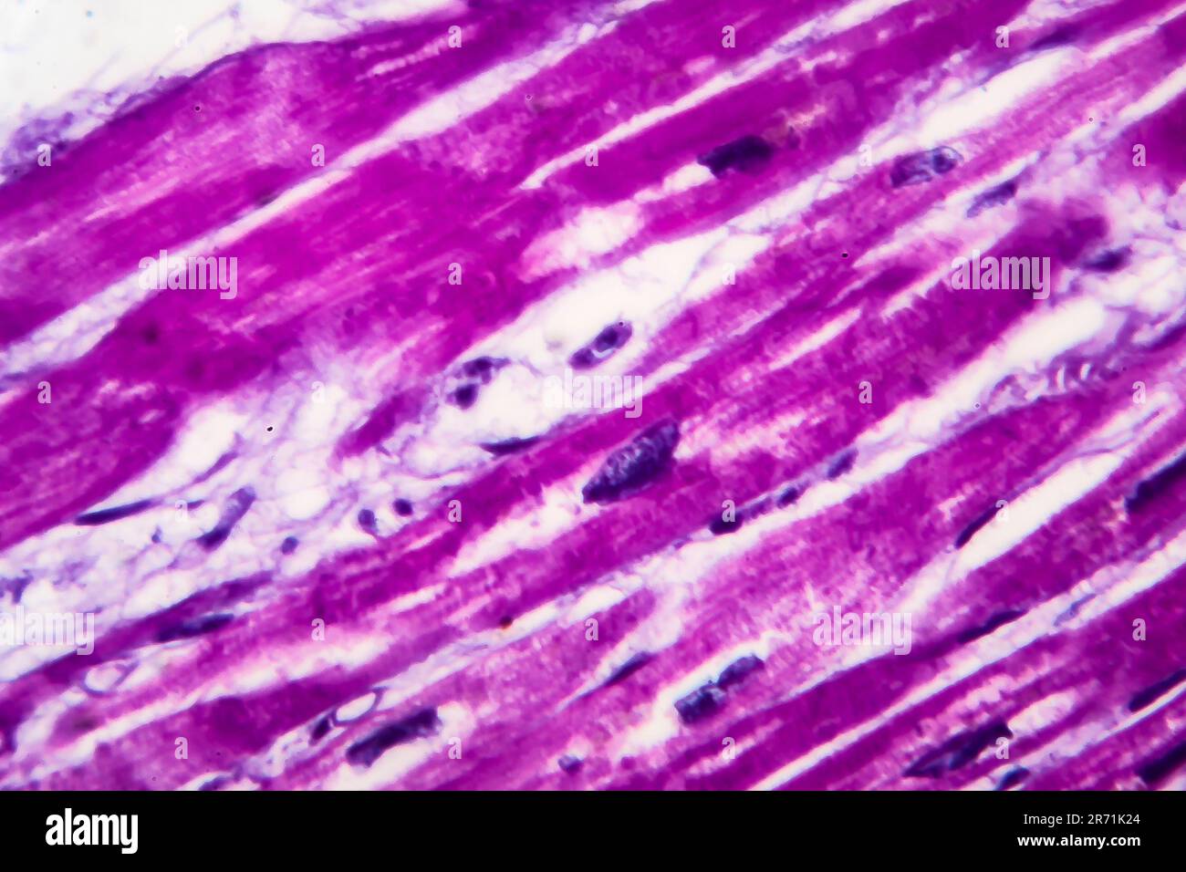 Hypertrophy Muscle Microscope