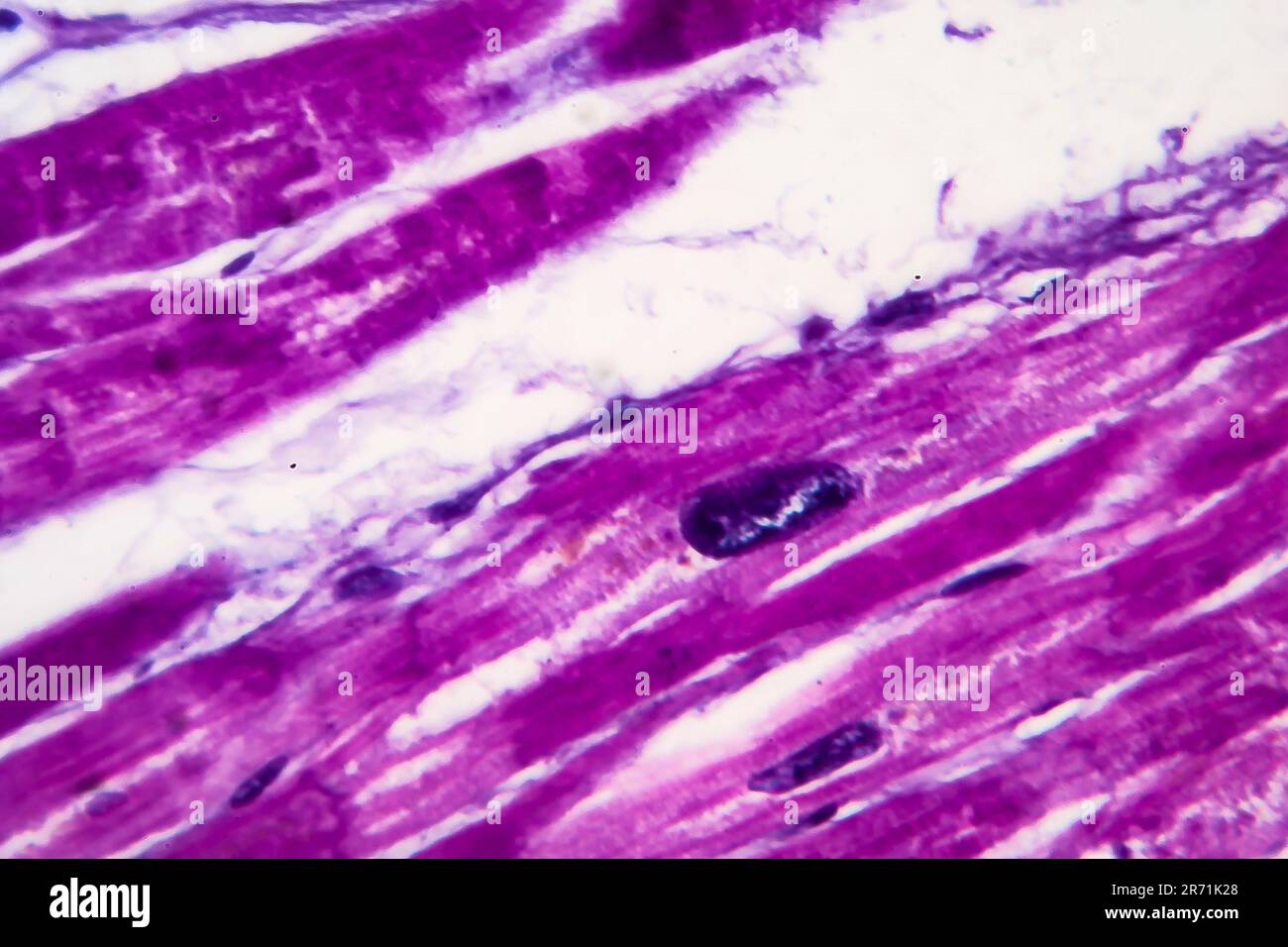 Hypertrophy Muscle Microscope
