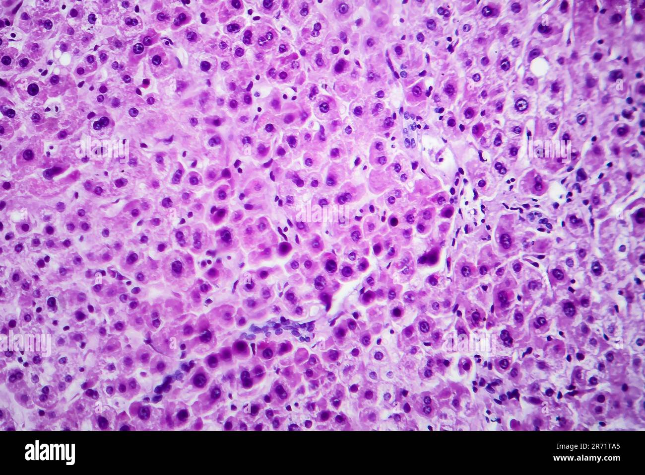 Liver cell microscope hi-res stock photography and images - Alamy