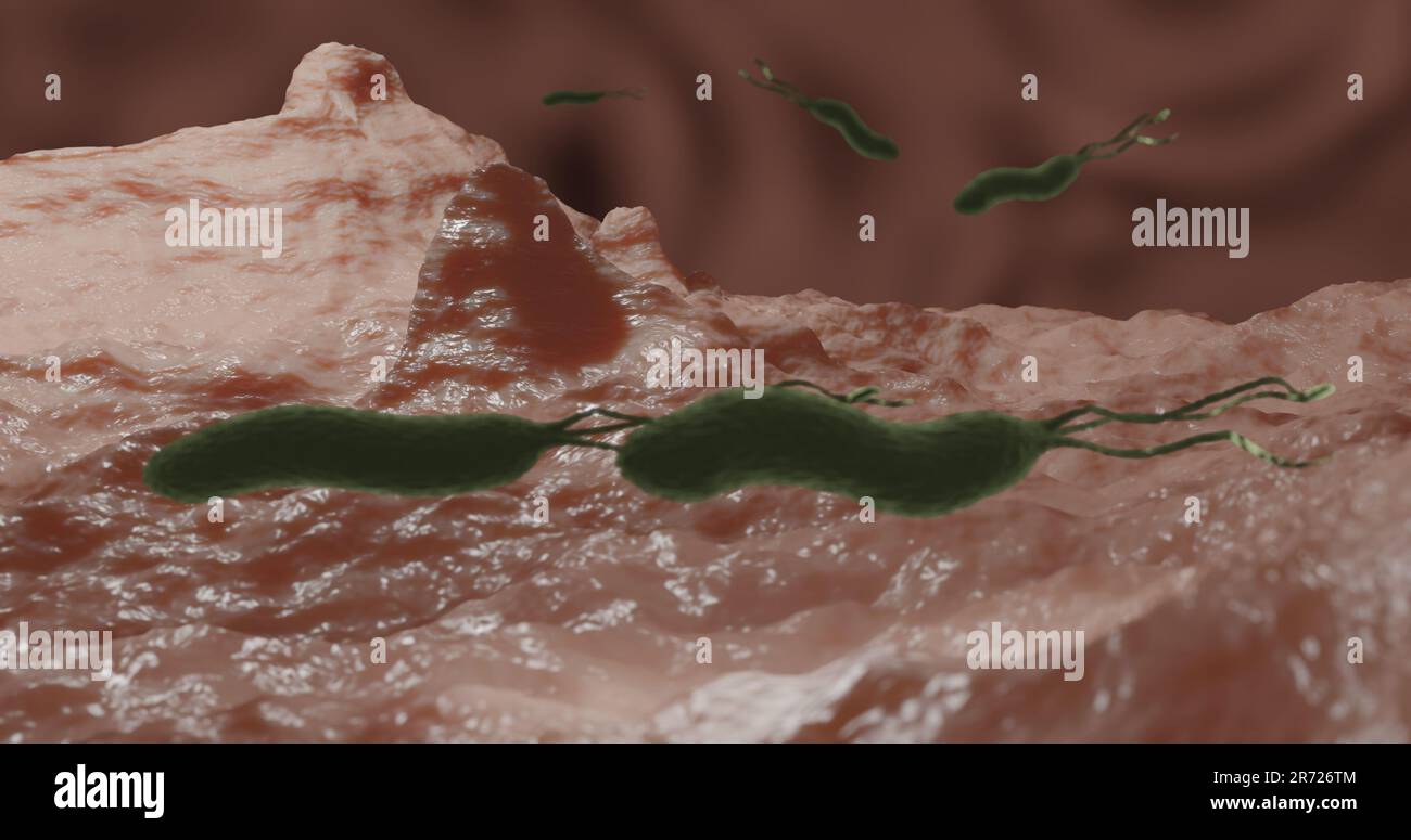 Helicobacter pylori or H. pylori, the bacillus of ulcer in 3D ...