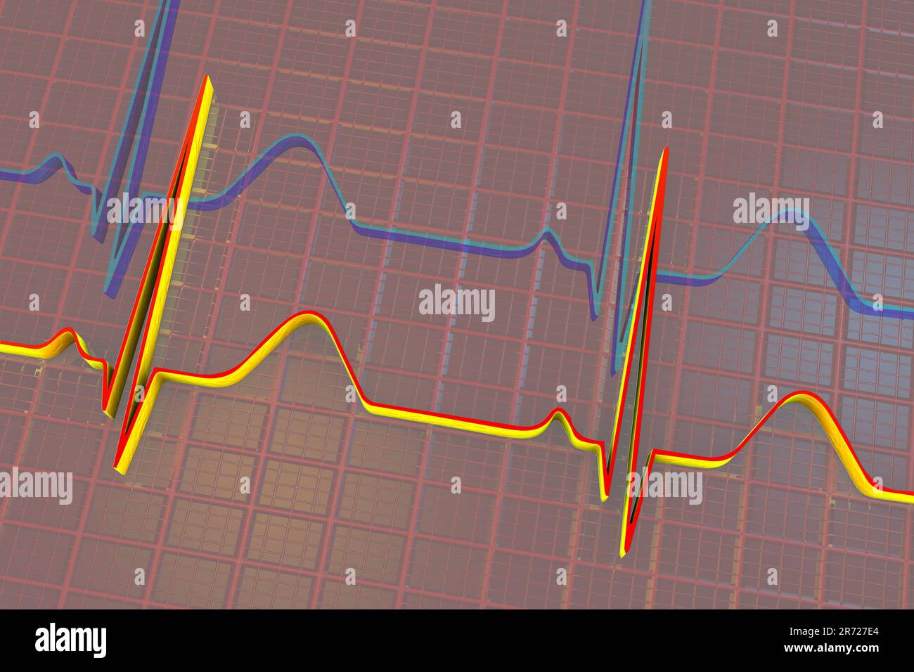 ECG. Computer artwork of an electrocardiogram (ECG) showing a normal ...