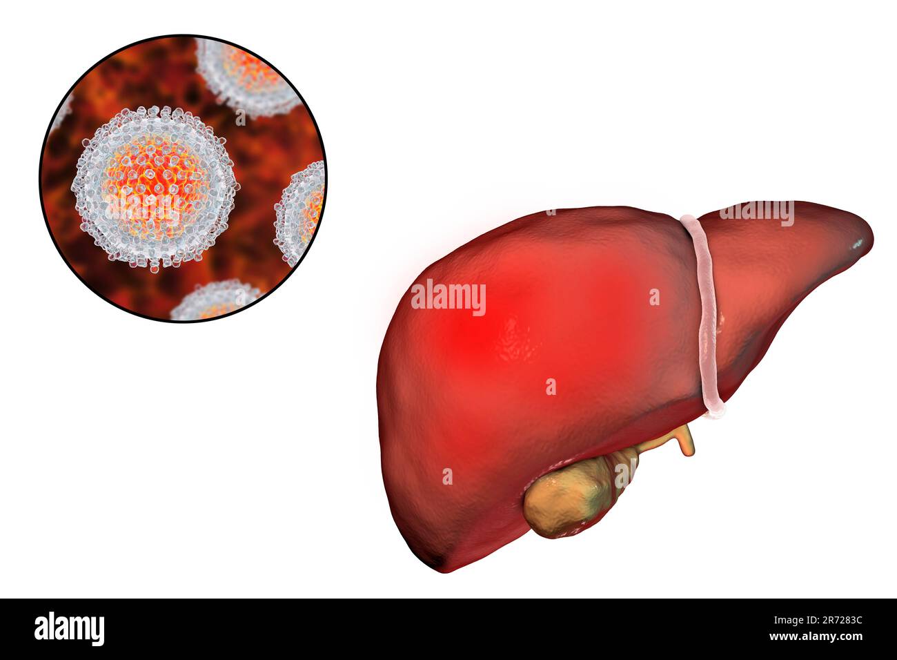 Hepatitis C Virus Liver