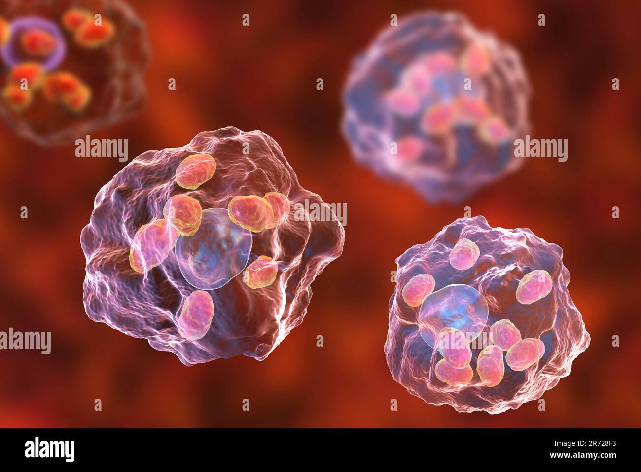 Amastigotes of Leishmania parasites inside macrophages, artwork ...