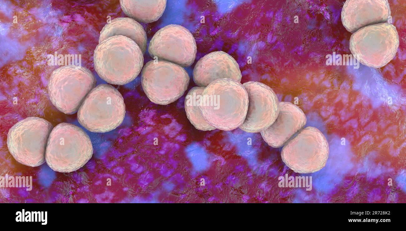 Streptococcus pneumoniae bacteria (pneumococci), computer illustration ...