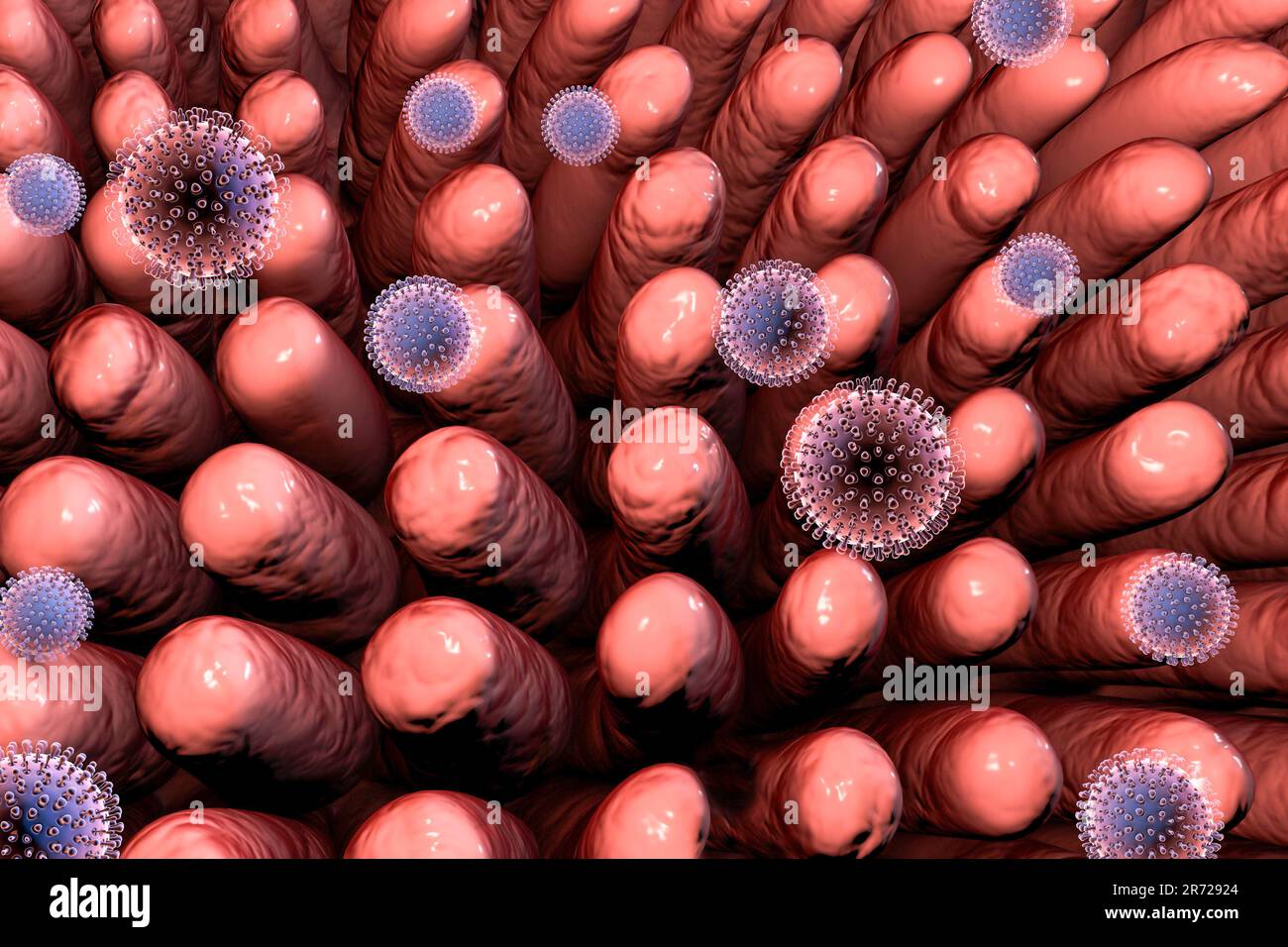 Rotaviruses infecting intestine, computer artwork. The virus particle ...