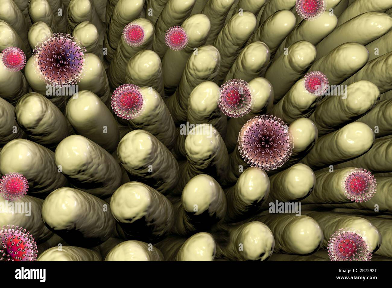 Rotaviruses infecting intestine, computer artwork. The virus particle ...