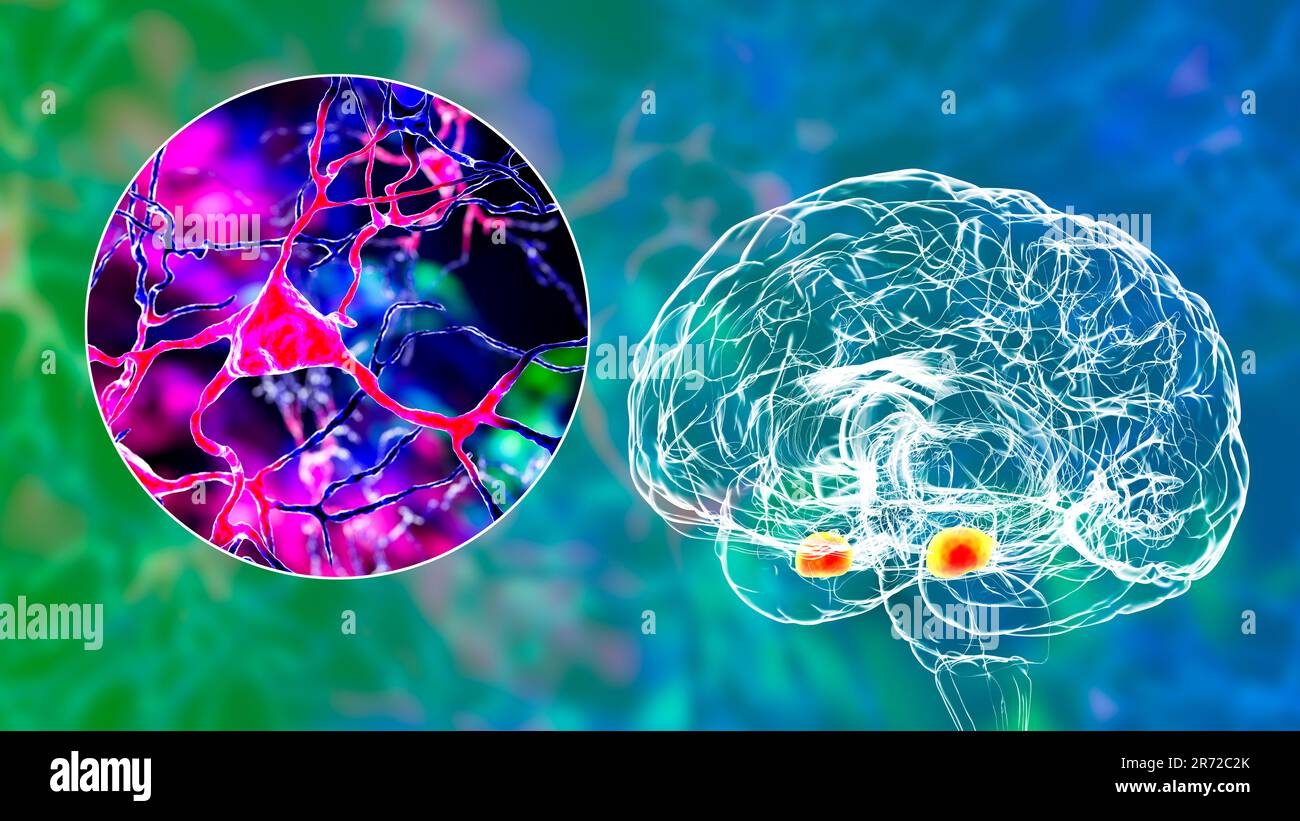 Almond shaped body in brain hi-res stock photography and images - Alamy