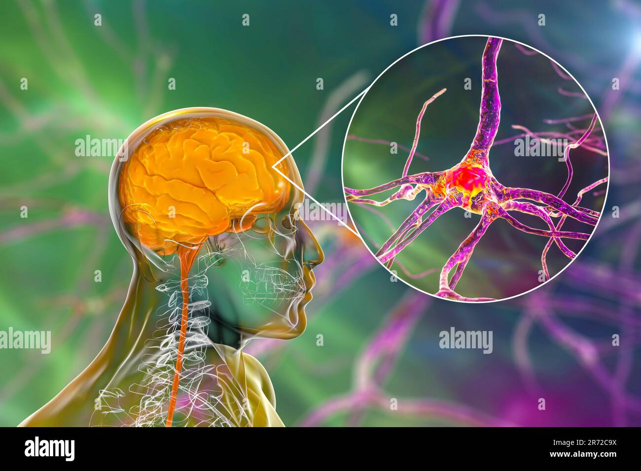 Human brain with close-up view of neurons, computer illustration Stock ...