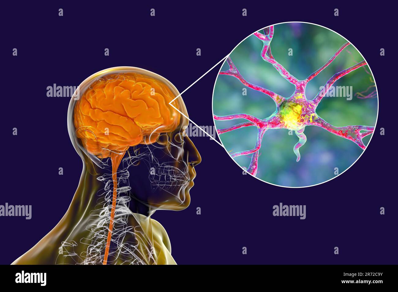 Human brain with close-up view of neurons, computer illustration Stock ...