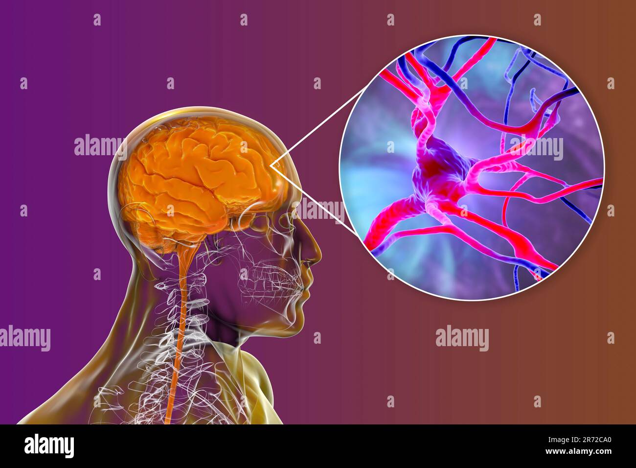 Human brain with close-up view of neurons, computer illustration Stock ...