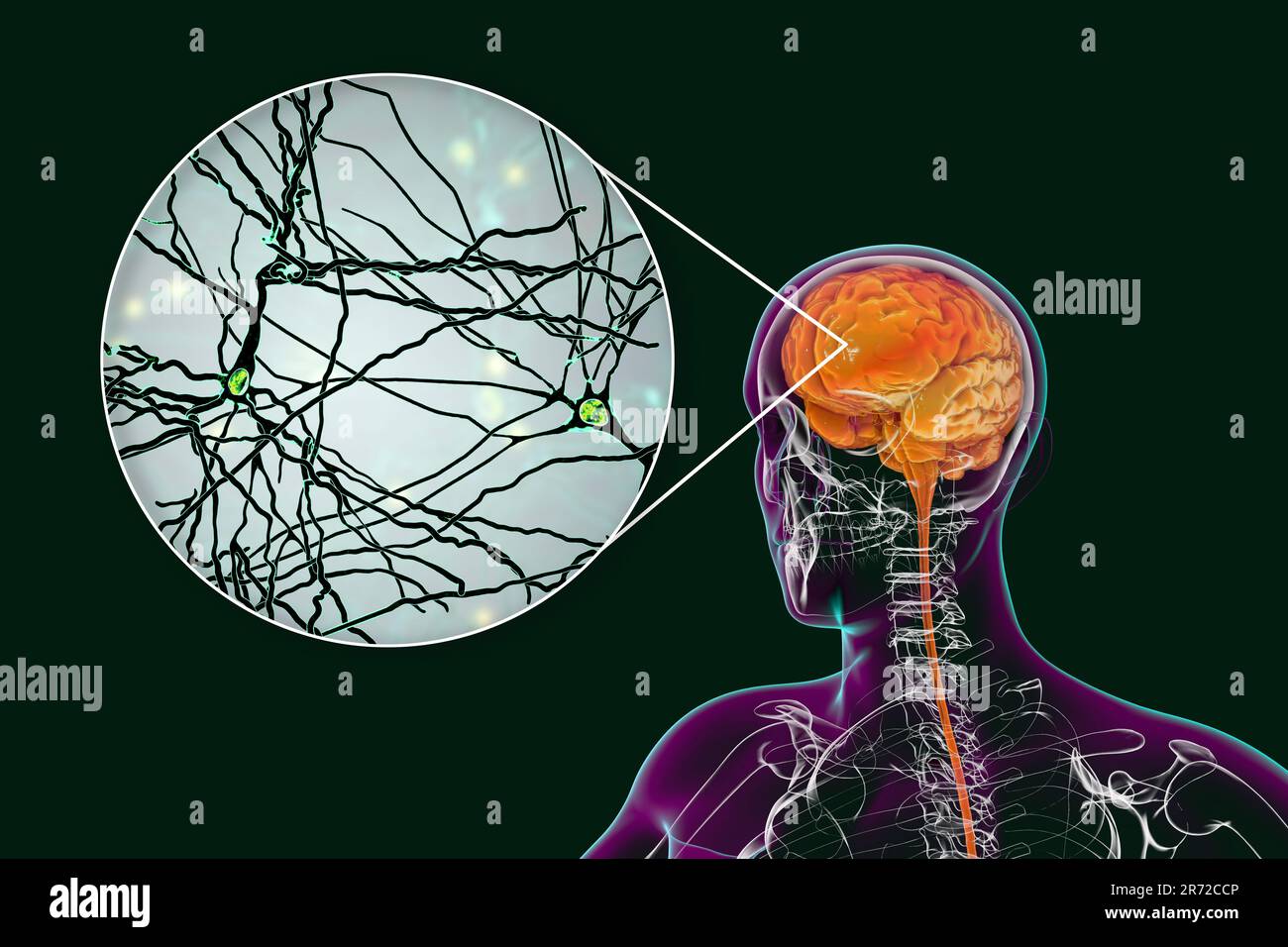 Human brain with close-up view of neurons, computer illustration Stock ...