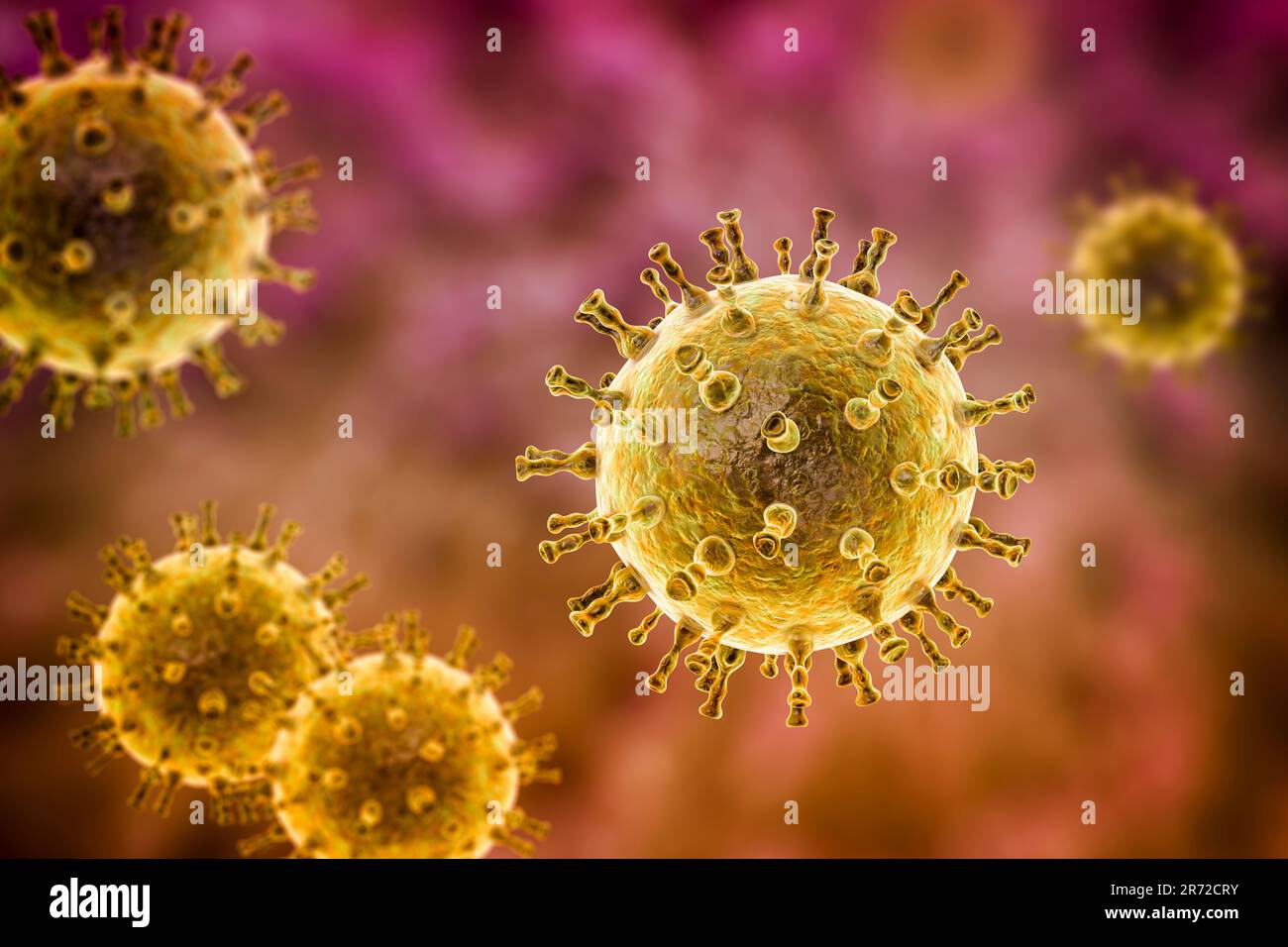 Computer illustration of a varicella zoster virus particle, the cause ...