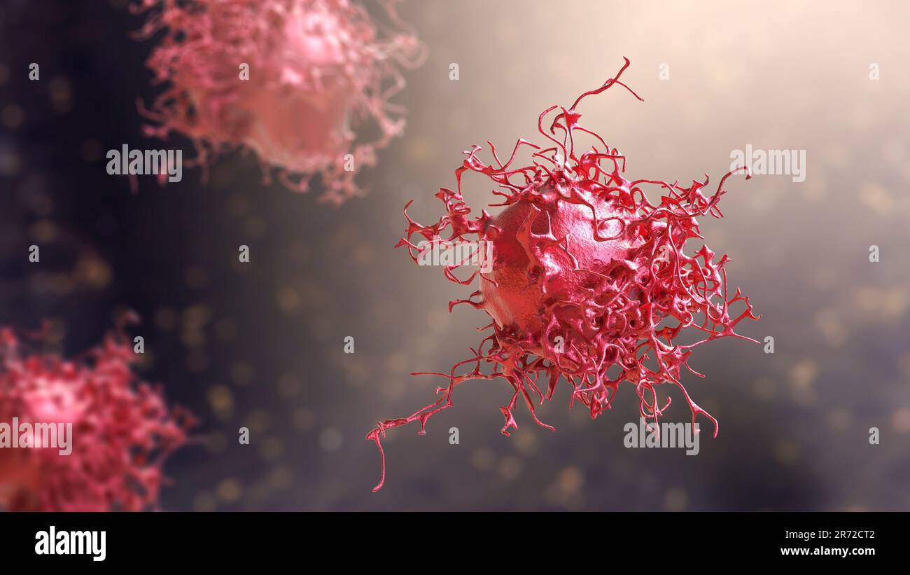 Cervical cancer cells, computer illustration Stock Photo - Alamy