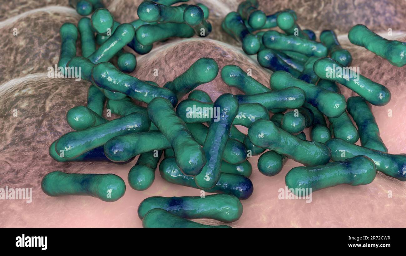 Corynebacterium diphtheriae, computer illustration. C. diphtheriae is a ...