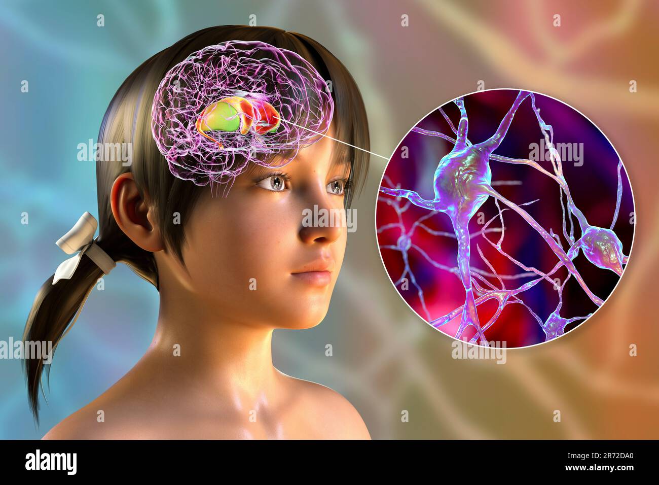 Dorsal striatum highlighted in child's brain and close-up view of its ...